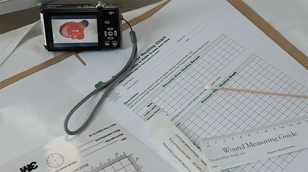 Comparing Silhouette wound imaging with digital camera options - ARANZ ...